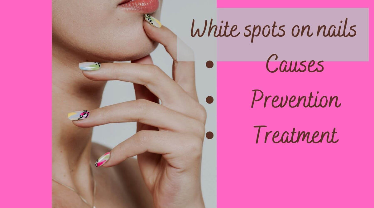 White Spots on Nails: Causes & Treatments Explained